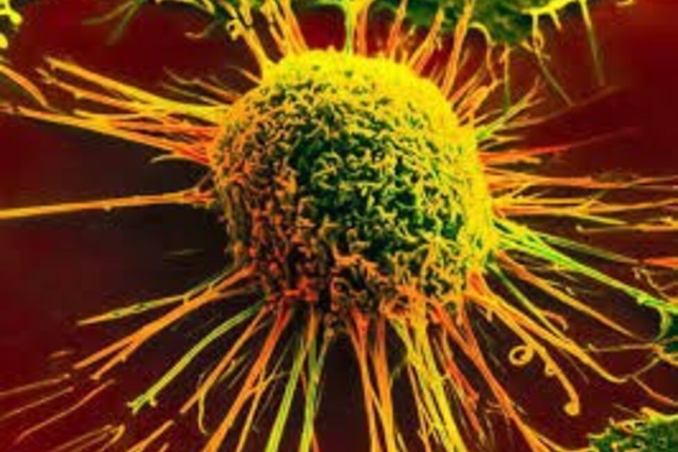 O comprimido que pode revolucionar o cancro do pâncreas - Ciência ...