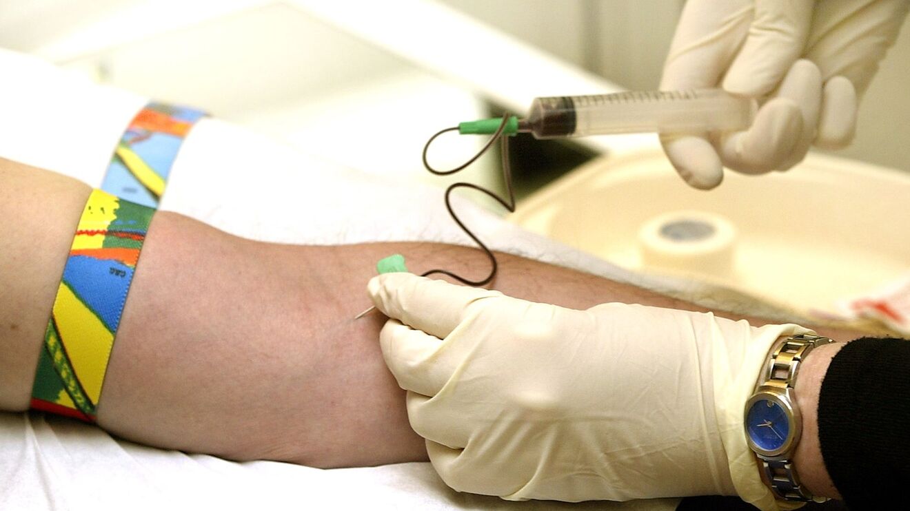 A varíola pode estar de volta - Ciência & Saúde - SÁBADO