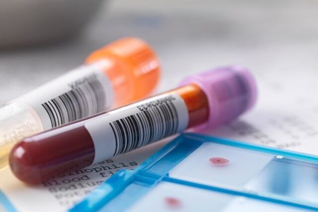 Tem sangue O negativo? É urgente que faça doação - Portugal - SÁBADO